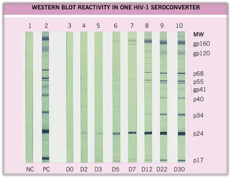 Western Blot Technique: Principle, Steps, Uses • Microbe Online Western Blot Technique: Principle, Steps, Uses • Microbe Online
